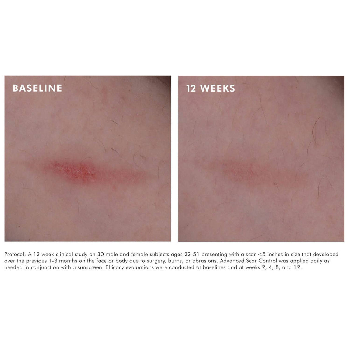 SkinCeuticals Advanced Sili- Gel | Body Clinic Skincare